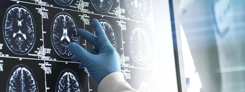 Different Types of MRI Scans and Their Applications - Cureasy Healthcare